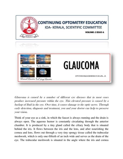 glaucoma and its management.pptx for nursing students | PPTX