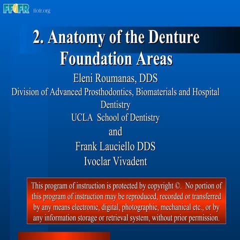 Anatomical Landmarks for Complete Dentures | PPTX