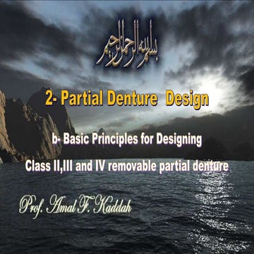 2- b. Basic principles for designing Kennedy class II, III and IV ...