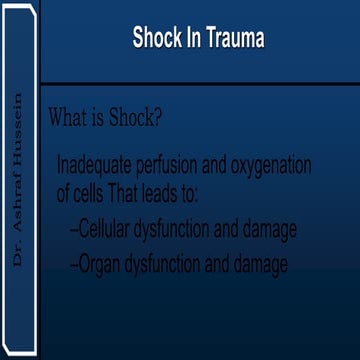 2- Hypovollemic Shock In Trauma.pptx
