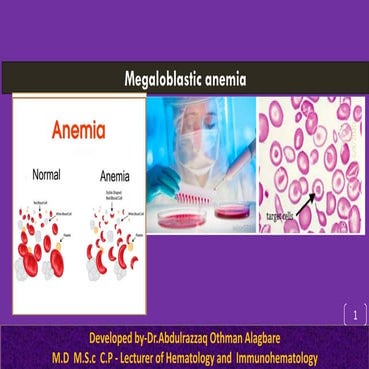Megaloblastic Anemia Rbc Pulsenotes | Macrocytic Anaemia