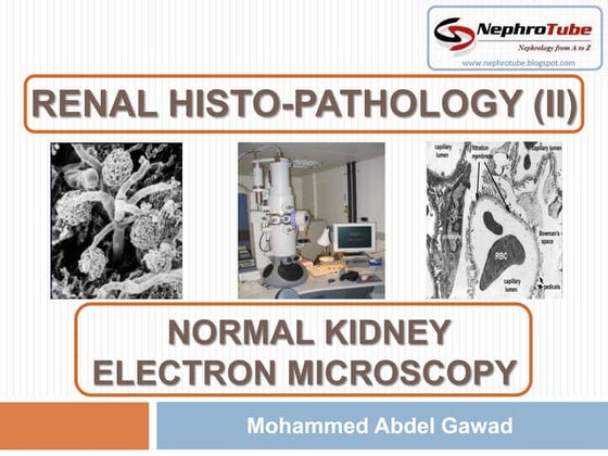 17 effaced pelvocalyceal system | PPT