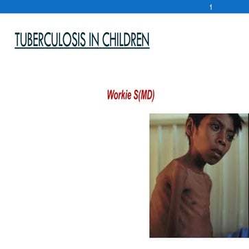 Approach to pediatric 2-TUBERCULOSIS(tb) | PPTX | Infectious Diseases ...