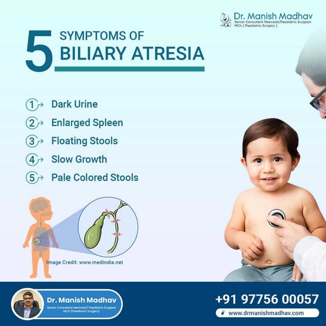 5 Symptoms Of Biliary Atresia | PDF