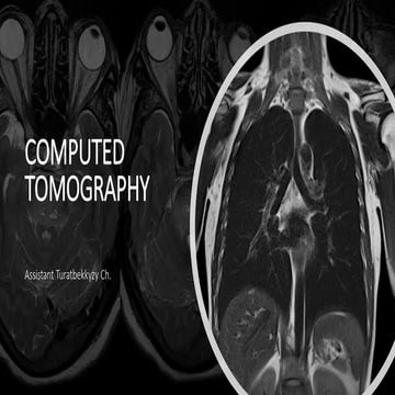 computed tomography | PDF