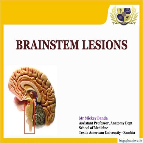Brain Stem Lesions Anatomy and Physiology | PPT