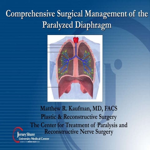 Comprehensive surgical management of the paralyzed diaphragm | PPT