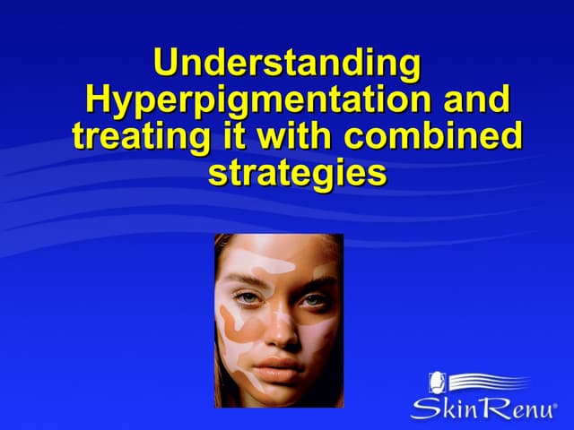 Skin pigmentation | Skin Pigmentation Disorders | PPTX