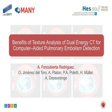 Benefits of texture analysis of dual energy CT for computer-aided pulmonary embolism detection | PPT