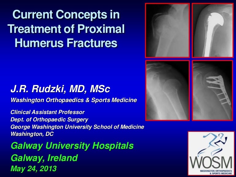 Current Concepts in Treatment of Proximal Humerus Fractures