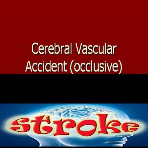 stroke | PPT