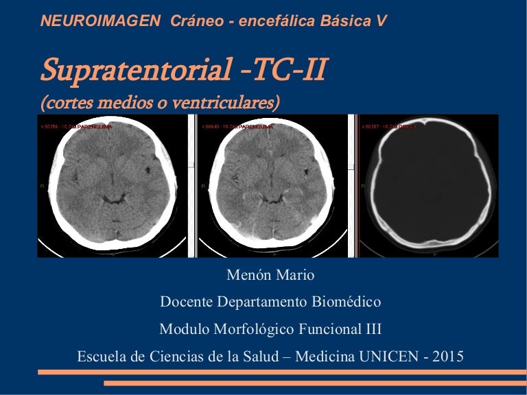 2015 supratentorial iitc