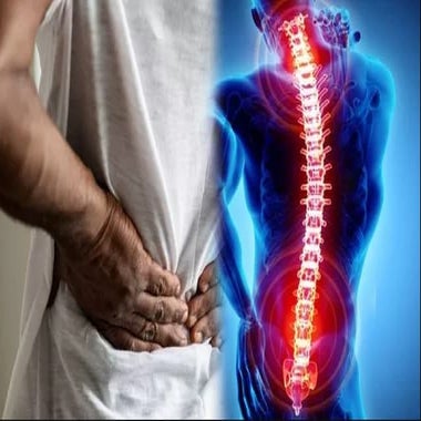 Back Pain | PDF