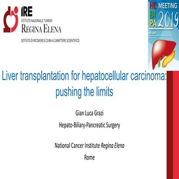 Liver transplantation for HCC - pushing the limits | PPTX