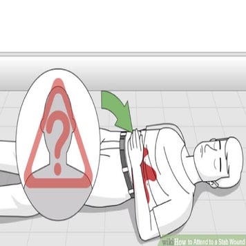 How to Attend to a Stab Wound | PPT