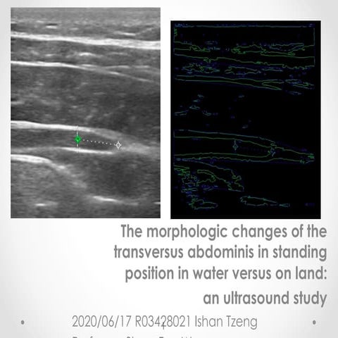 Muscle ultrasound for nutritional | PPTX