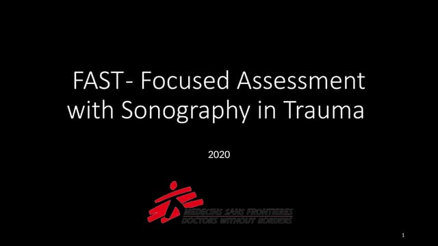E-Fast Examination | PPTX