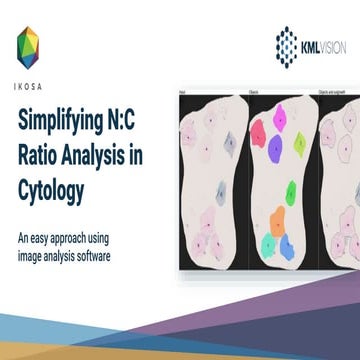 Simplifying N:C Ratio Analysis in Cytology: An Easy Approach Using ...