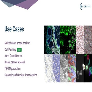 Various Image Analysis Use Cases solved with IKOSA | PDF