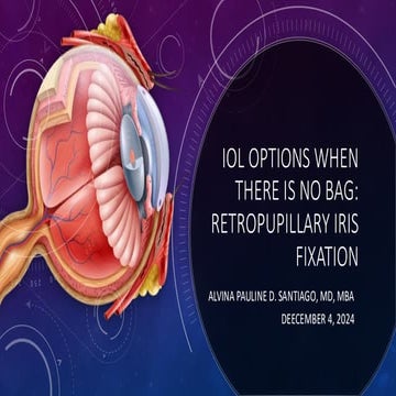 IOL Options When There is No Bag: Retropupillary Iris Fixation.pdf