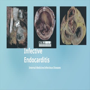 2025 LECTURE-INFECTIVE ENDOCARDITIS.pptx