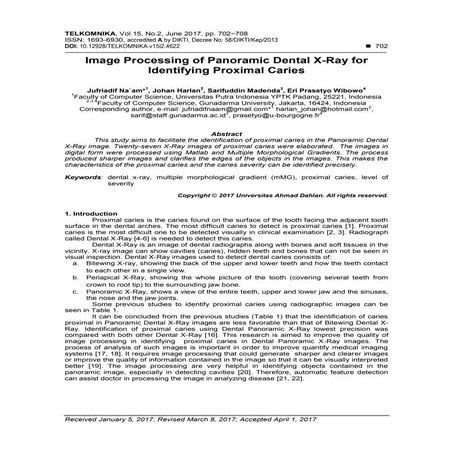 Image Processing of Panoramic Dental X-Ray for Identifying Proximal ...