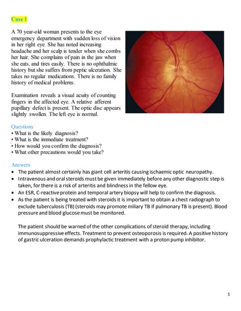118 ophthalmology Questions & Answers - MCQ | PDF