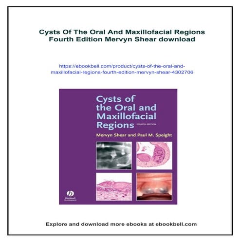 Cysts Of The Oral And Maxillofacial Regions Fourth Edition Mervyn Shear ...
