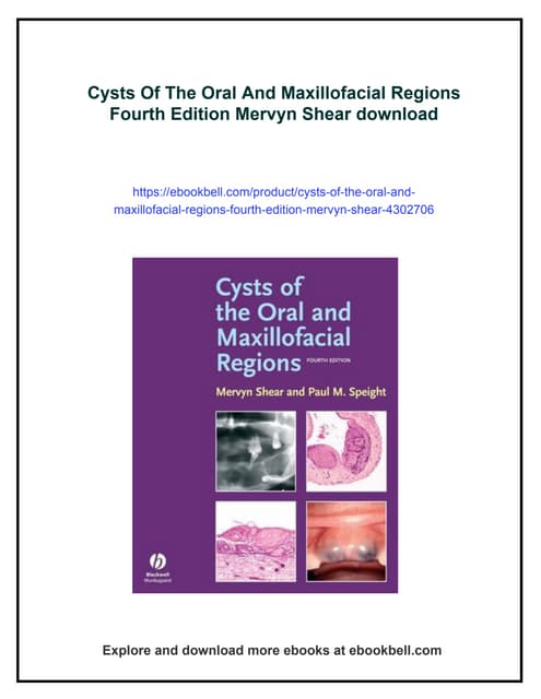 Classification of odontogenic cyst | PPTX | Dental Health | Diseases ...