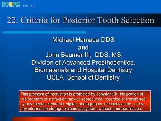 22.criteria for posterior tooth selection | PPT