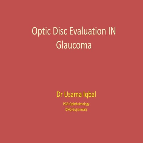 22 Optic Disc Evaluation In Glaucoma Ppt