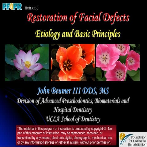 Restoration of Facial Defects - Basic Priniciples | PDF