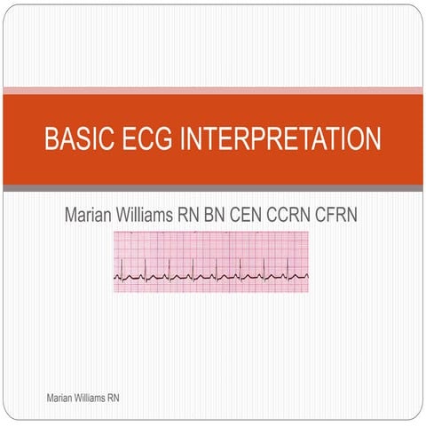 electrocardiogram power point, basic ecg interp | PPT