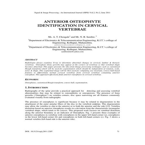Anterior Osteophyte Identification in Cervical Vertebrae | PDF