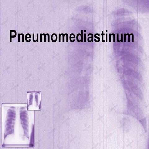 Pneumomediastinum | PPSX