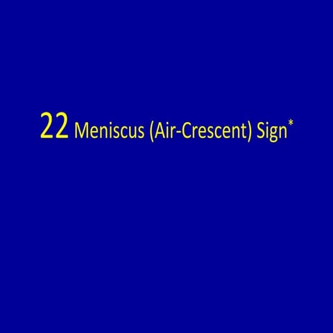 22 meniscus (air crescent) sign | PPT