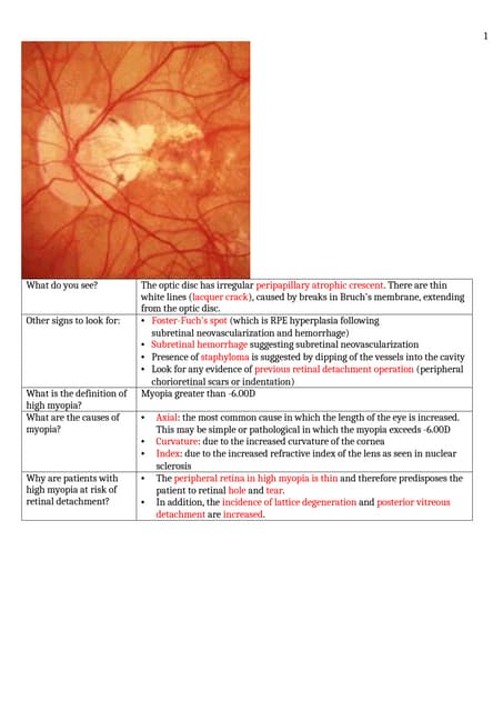 OSCE ophthalmology examination & answers | DOCX