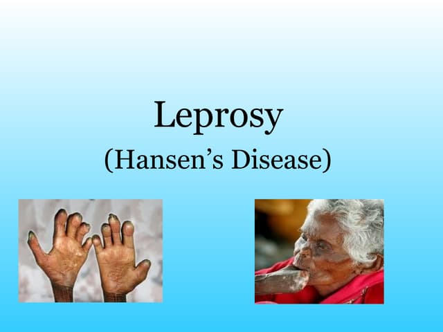 Leprosy | PPT