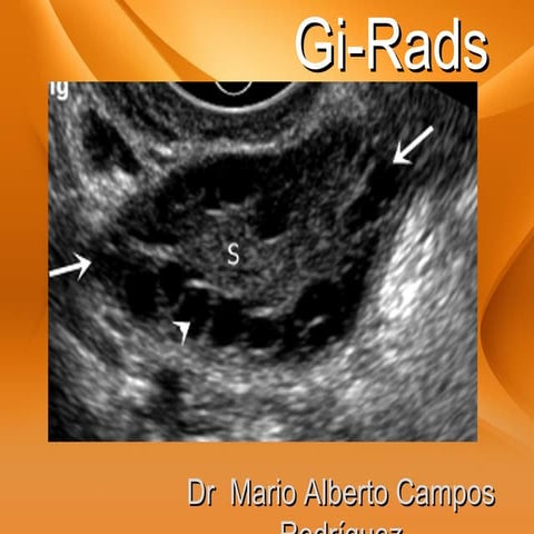 Sistema Gy-Rads | PPT