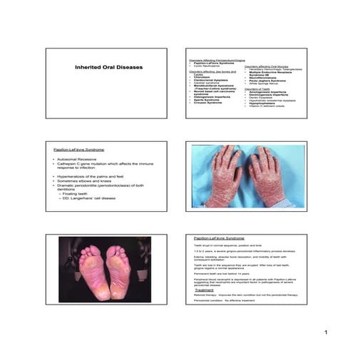 Premature exfoliation of primary teeth | PPTX