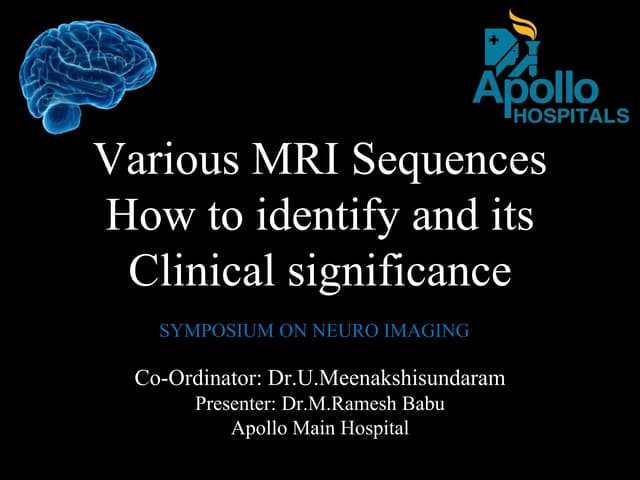 MRI Epilepsy protocol | PPTX