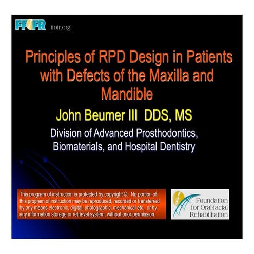 12.surveyed crowns and combined fixed rpd cases | PDF