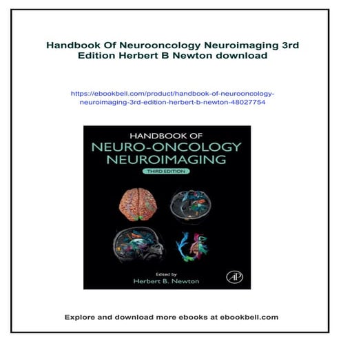 Handbook Of Neurooncology Neuroimaging 3rd Edition Herbert B Newton | PDF