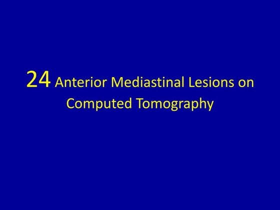 25 middle mediastinal lesions | PPT