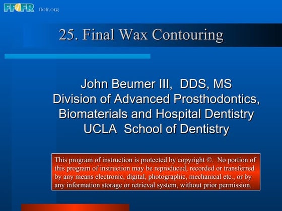 Components of a complete denture | PPT