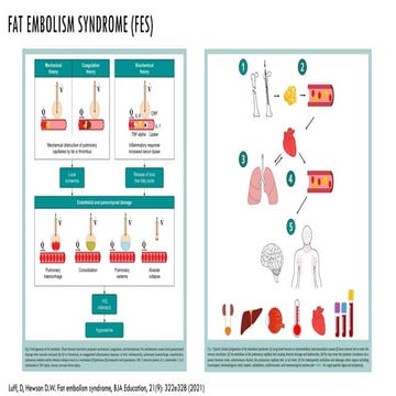 Fat Embolism Syndrome From Orthobullet.pptx