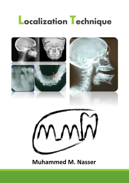 SLOB Technique | PPTX