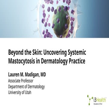 Beyond the Skin: Uncovering Systemic Mastocytosis in Dermatology ...