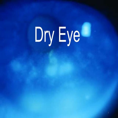 271_dry_eye (1).pptx