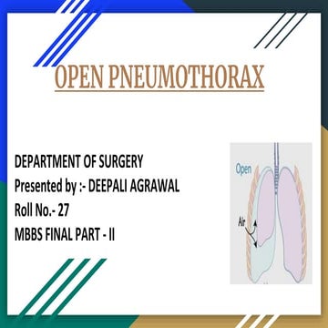 Open pneumothorax | PPTX